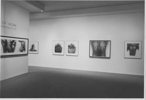 John Coplans. Hands Spread on Knees. 1985 | MoMA