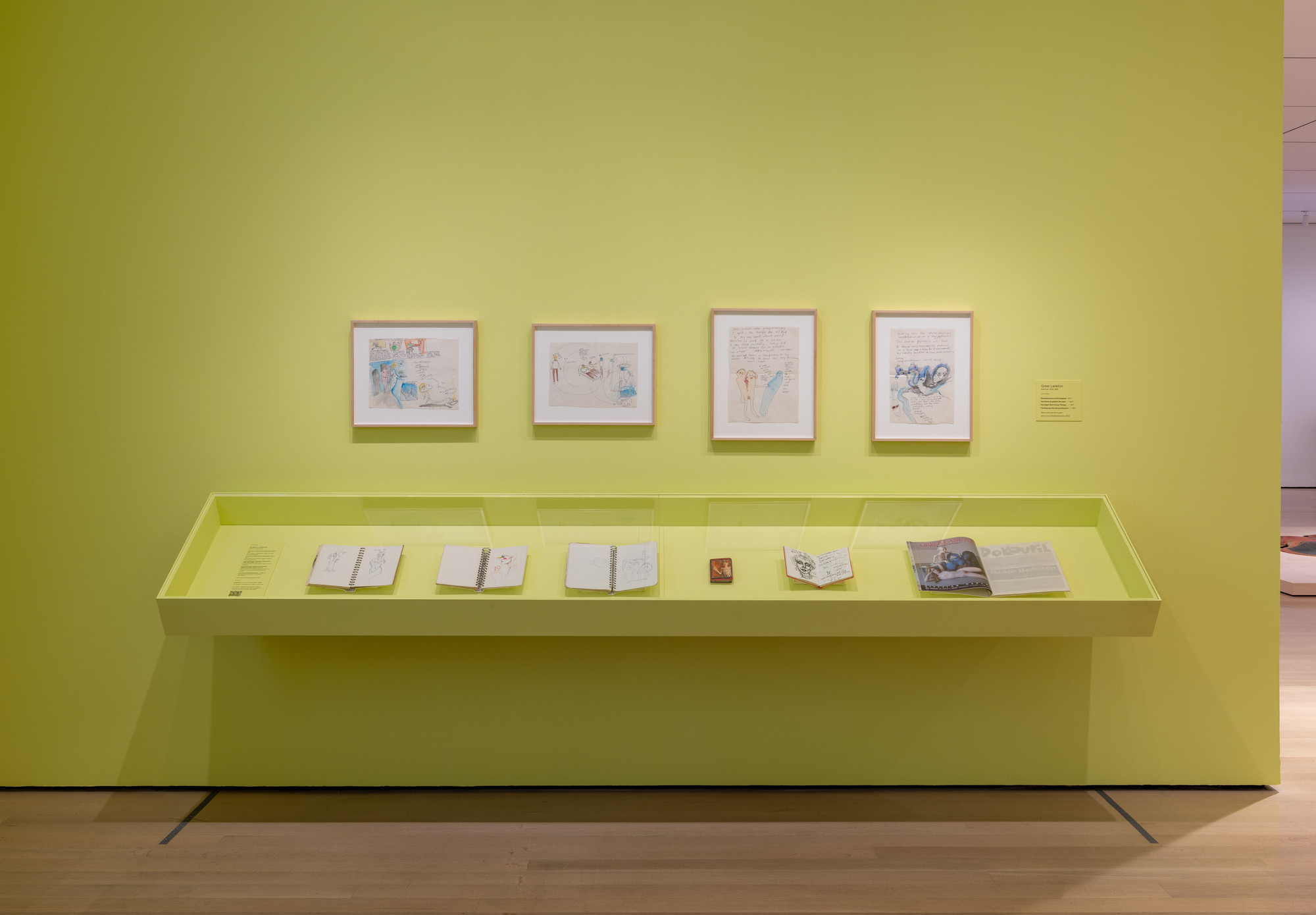 Installation view of the exhibition “Vital Signs: Artists and the Body ...