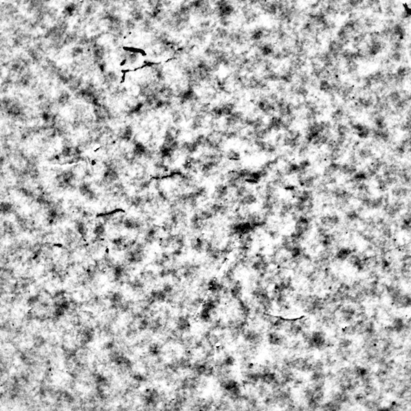 Right Eye | Object:Photo | MoMA