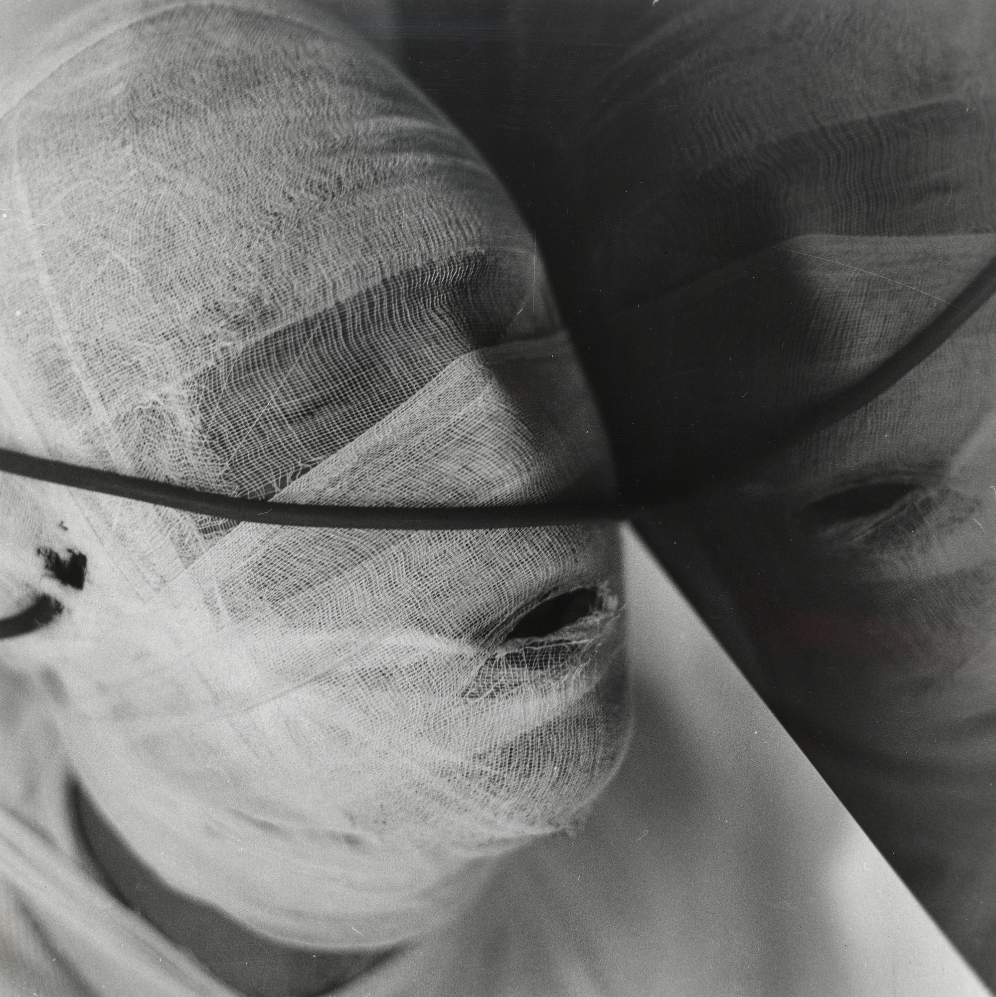 Rudolf Schwarzkogler, Michael Epp. 6th Action, (gauzed face and ...