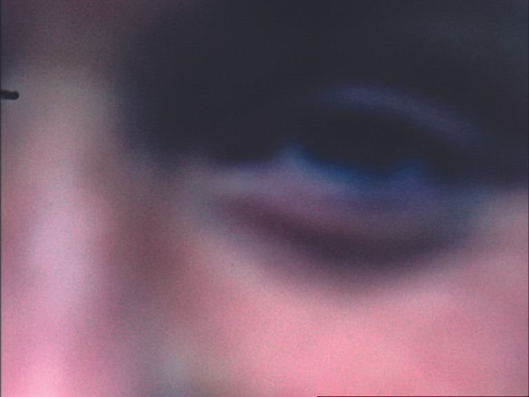 VALIE EXPORT. Self Portrait With Eye. 1970 | MoMA