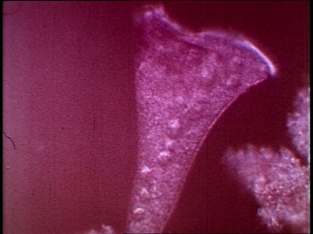 Steve Reinke. Stentor from The Hundred Videos. 1996 | MoMA