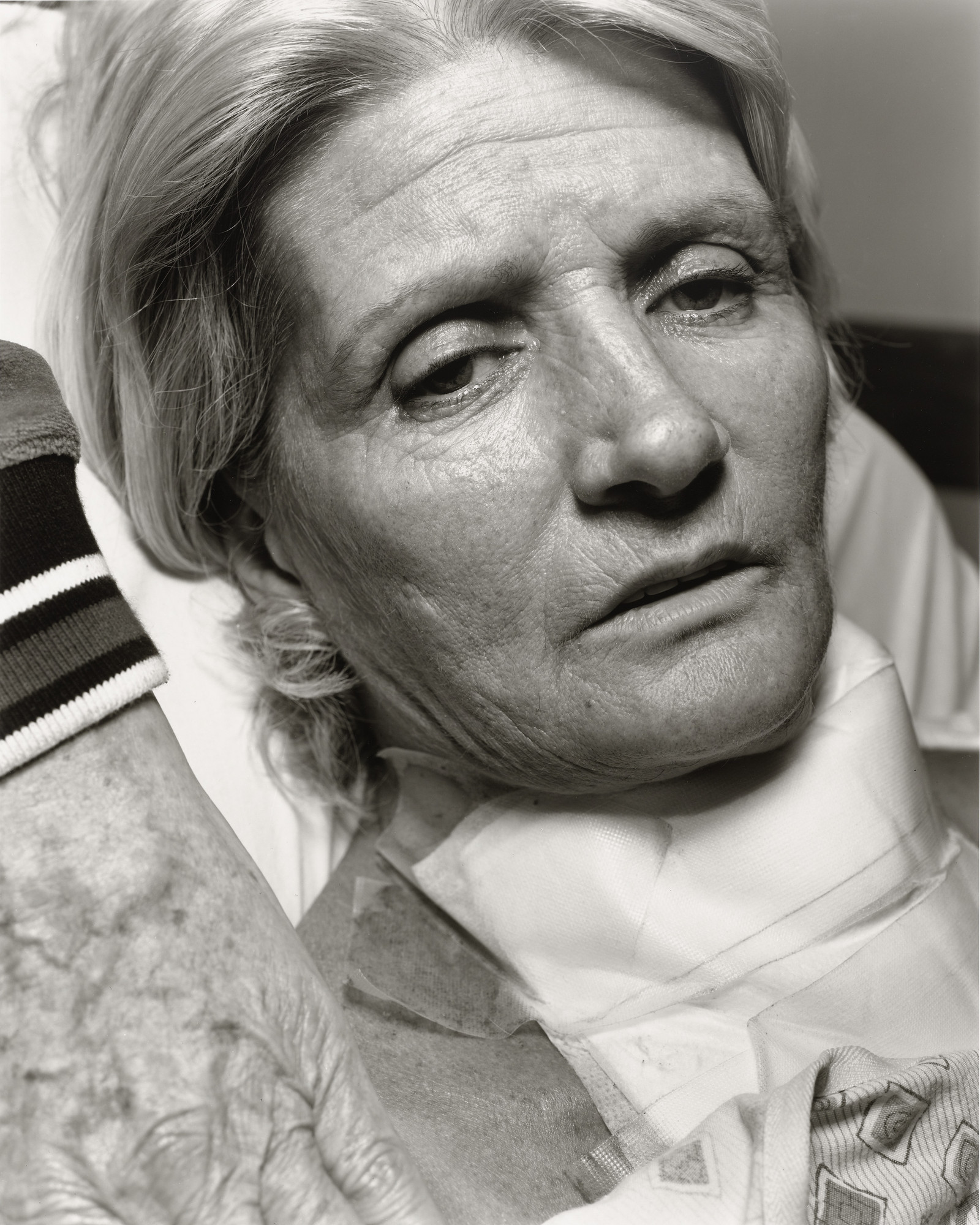 Nicholas Nixon. Maureen Chiminello, Boston Medical Center. 2007 | MoMA