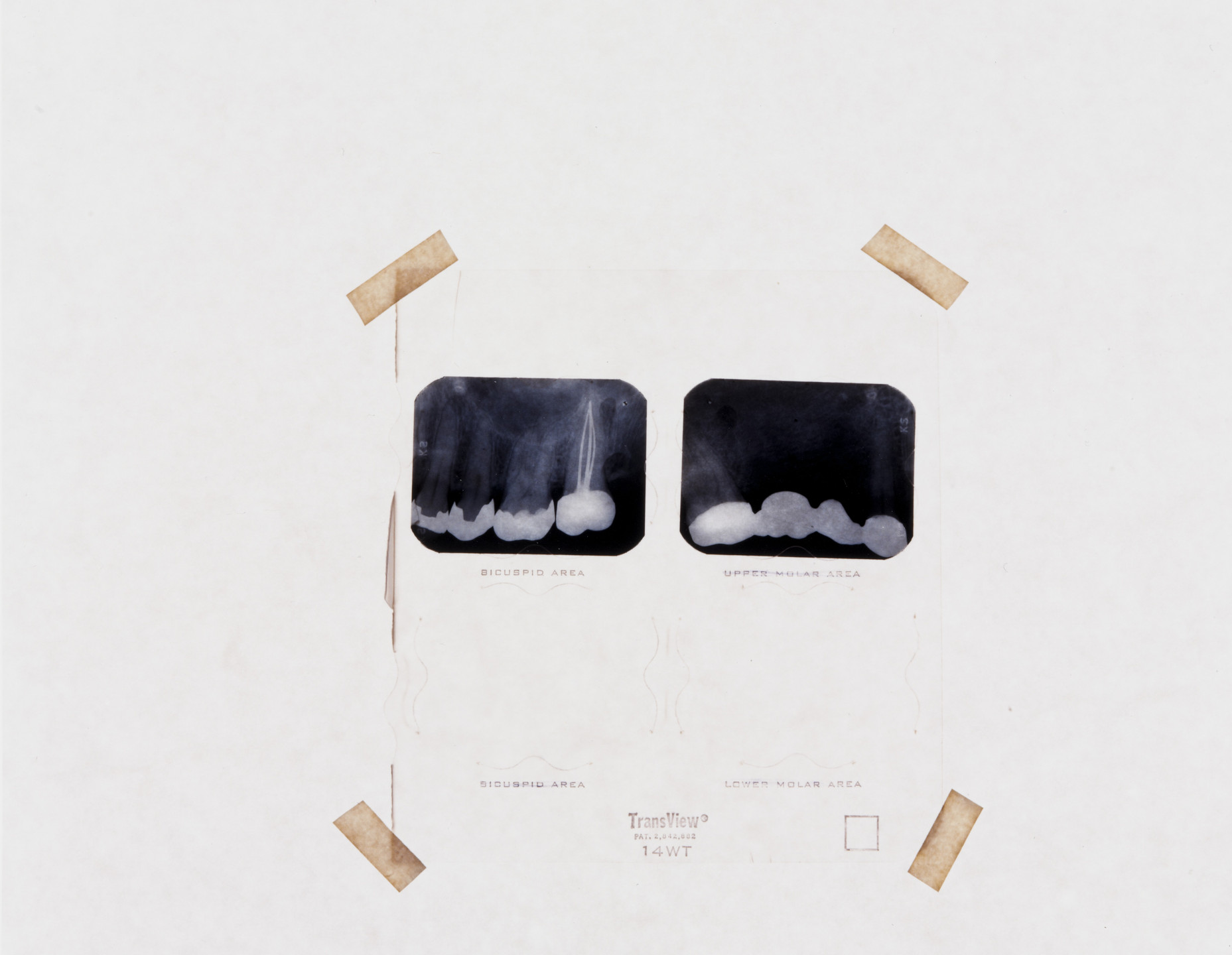 Lynn Hershman Leeson. Dental X-Ray. 1975 | MoMA